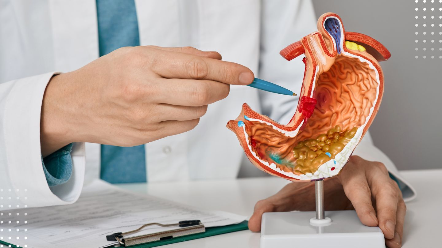 How Does Gastric Sleeve Work: Everything You Need to Know