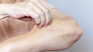 Loose Skin After Weight Loss Surgery: How to Manage It?