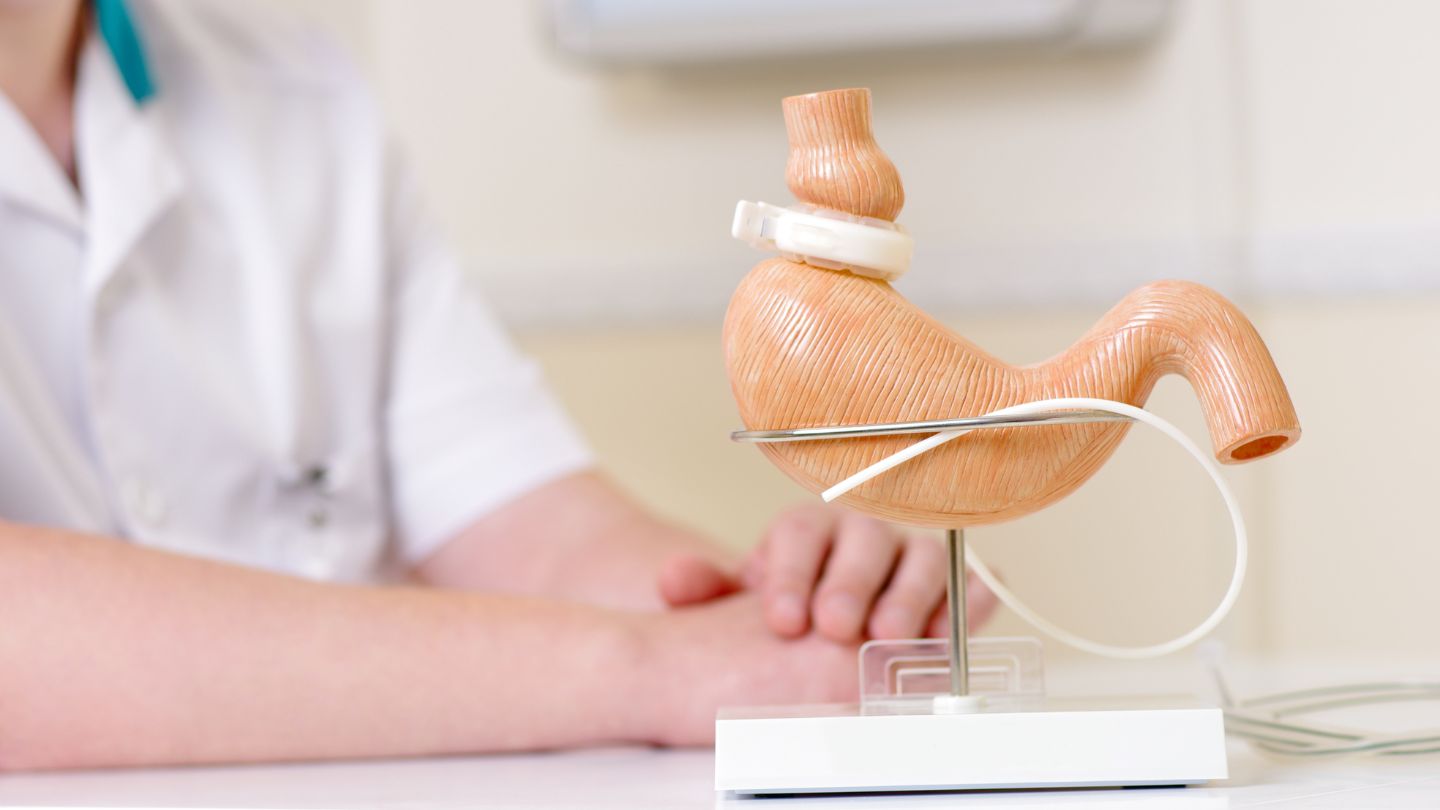 Do I Qualify for Lap Band Surgery? Qualifications Explained